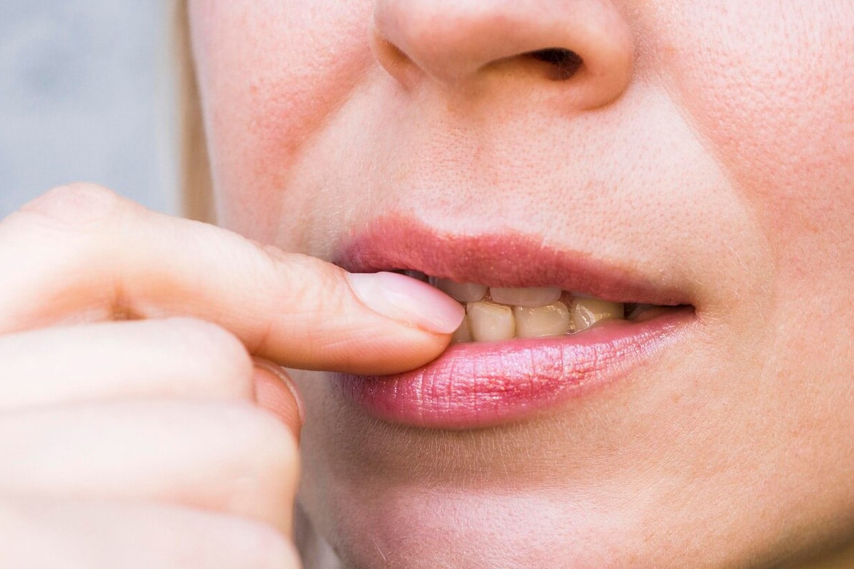 Bad Habits to Avoid If You Want Healthy Teeth and Gums | American ...
