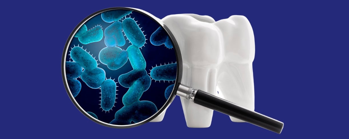 Oral Bacteria DNA Test: Unlocking Dental Health Insights